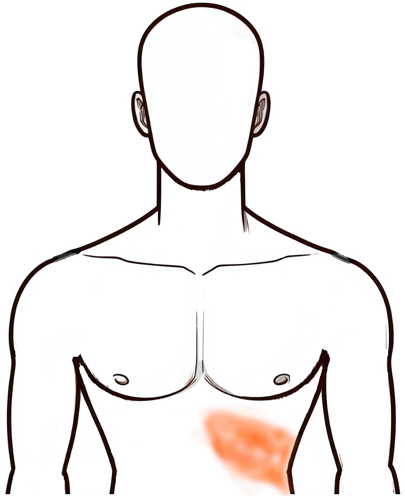 帯状疱疹の痛みは通常、両側に出る？片側のみ？ | 正直薬剤師のここだけの話
